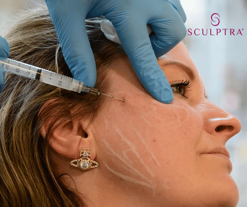 Biostimulator Injections - SRGN Clinic